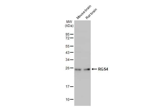 RGS4 Monoclonal Antibody (HL1522), Invitrogen 100 μL; Unconjugated ...