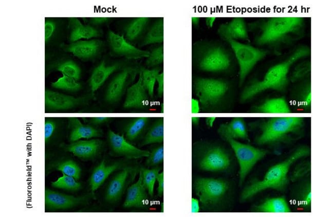 POLB Monoclonal Antibody (HL1525), Invitrogen 100 μL; Unconjugated ...