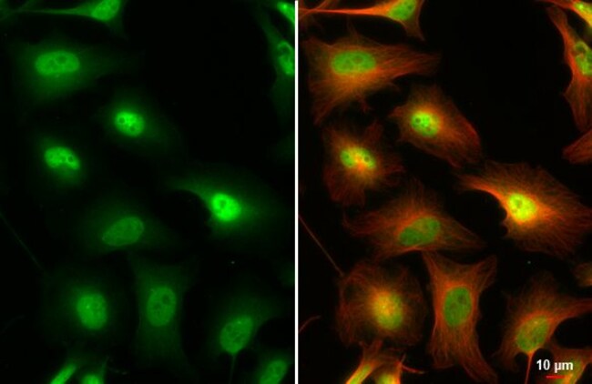 IKK gamma Monoclonal Antibody (HL1577), Invitrogen 100 μL; Unconjugated ...