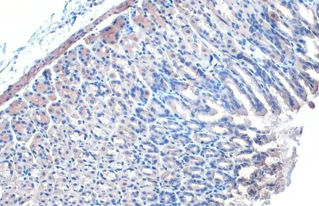 IKK gamma Monoclonal Antibody (HL1577), Invitrogen 100 μL; Unconjugated ...