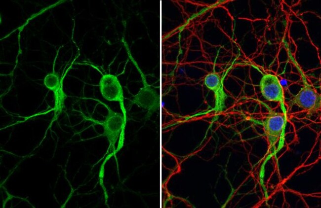 MAP2 Monoclonal Antibody (HL1656), Invitrogen 100 μL; Unconjugated ...