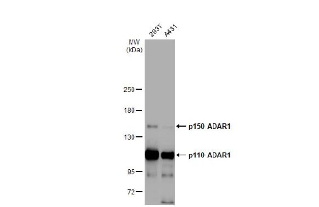 ADAR1 Recombinant Rabbit Monoclonal Antibody (HL1789), Invitrogen 100 ...
