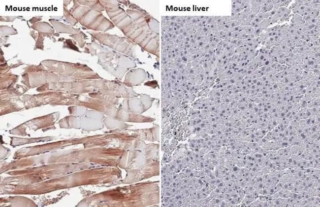 TRIM72 Monoclonal Antibody (HL1855), Invitrogen 100 μL; Unconjugated ...