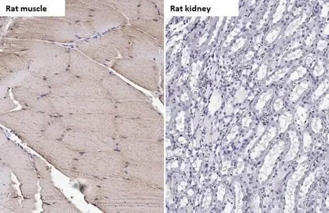 TRIM72 Monoclonal Antibody (HL1855), Invitrogen 100 μL; Unconjugated ...