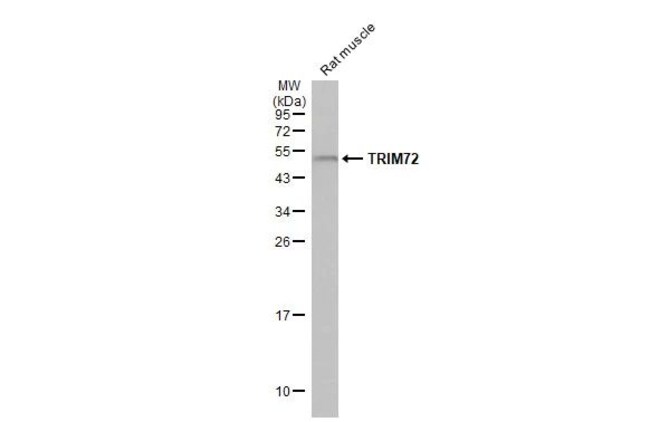 TRIM72 Monoclonal Antibody (HL1855), Invitrogen 100 μL; Unconjugated ...