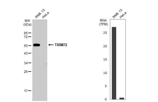 TRIM72 Monoclonal Antibody (HL1855), Invitrogen 100 μL; Unconjugated ...