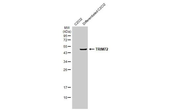 TRIM72 Monoclonal Antibody (HL1855), Invitrogen 100 μL; Unconjugated ...