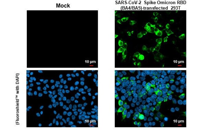 SARS-CoV-2 Spike Protein RBD Omicron Recombinant Rabbit Monoclonal ...