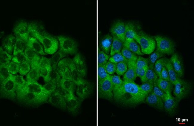 Ataxin 2 Monoclonal Antibody (HL1902), Invitrogen 100 μL; Unconjugated ...