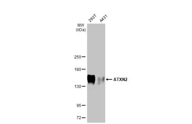 Ataxin 2 Monoclonal Antibody (HL1902), Invitrogen 100 μL; Unconjugated ...