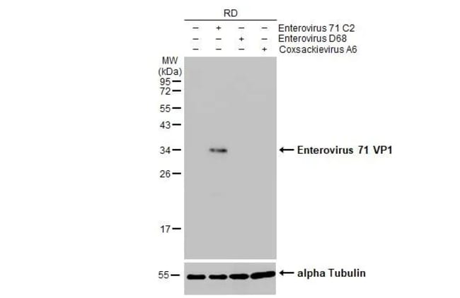 Enterovirus 71 VP1 Monoclonal Antibody (HL1929), Invitrogen 100 μL ...