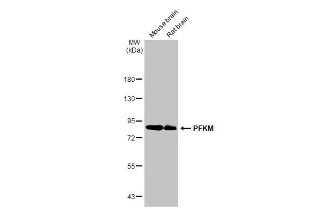 PFKM Monoclonal Antibody (HL2010), Invitrogen 100 μL; Unconjugated ...