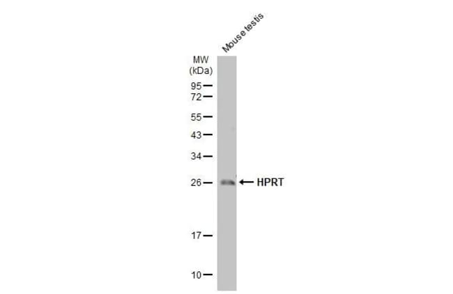 HPRT1 Monoclonal Antibody (HL2015), Invitrogen 100 μL; Unconjugated ...