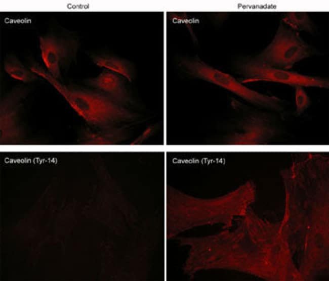 Invitrogen Phospho-Caveolin 1 (Tyr14) Monoclonal Antibody (M283) 100 μL ...
