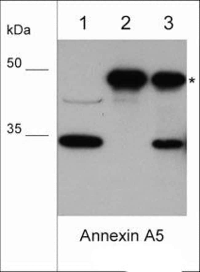 Invitrogen Annexin V Monoclonal Antibody (M017) 100 μL; Unconjugated ...