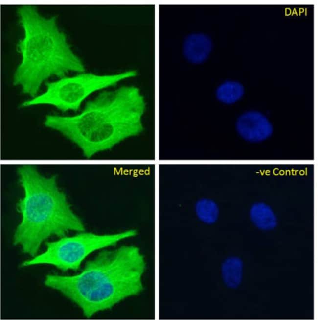 beta Tubulin Chimeric Recombinant Rabbit Monoclonal Antibody (S11B), Invitrogen | Fisher Scientific