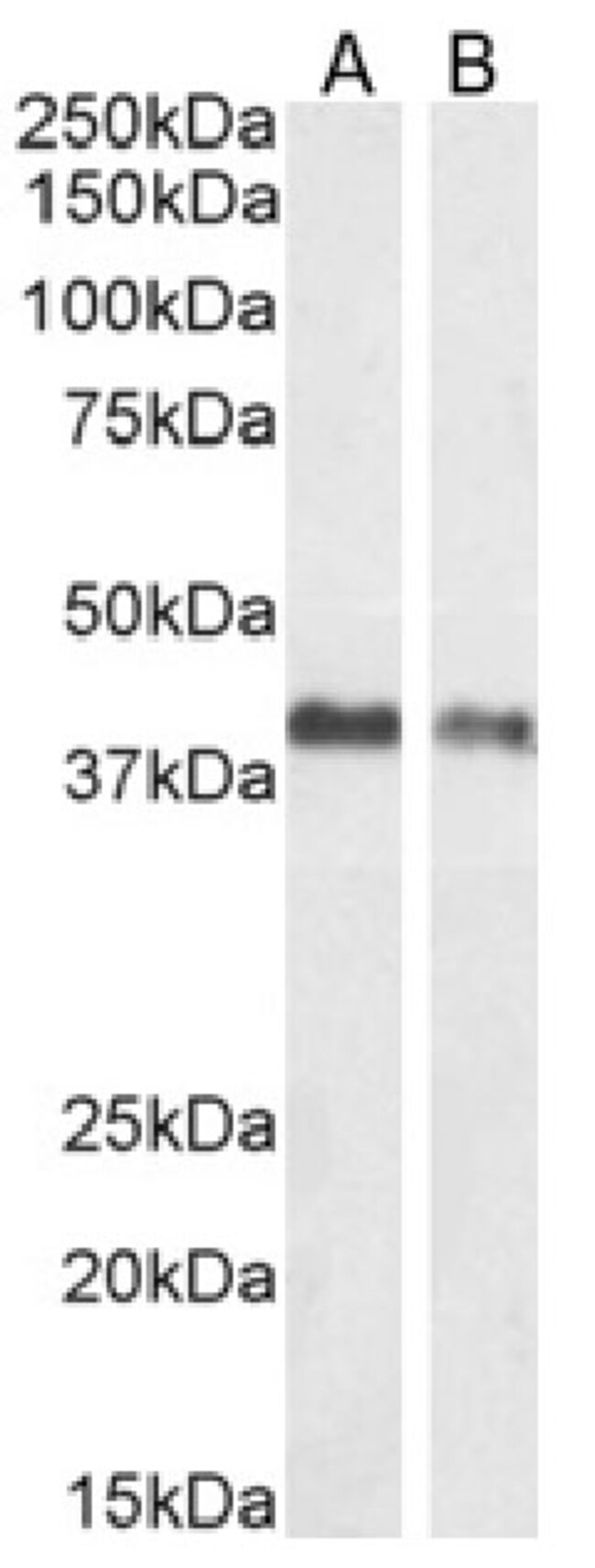 EpCAM (CD326) Recombinant Mouse Monoclonal Antibody (HEA125 ...