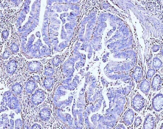 Moesin Monoclonal Antibody (8D4), Invitrogen 100 μg; Unconjugated:Antibodies, | Fisher Scientific