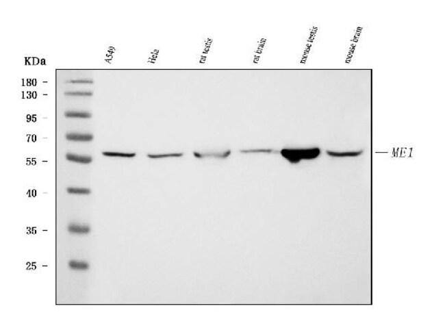 ME1 Monoclonal Antibody (5E5F7), Invitrogen 100 μg; Unconjugated ...