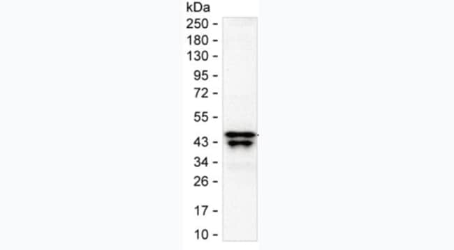 alpha-1 Microglobulin Monoclonal Antibody (KT158), Invitrogen 100 μg ...