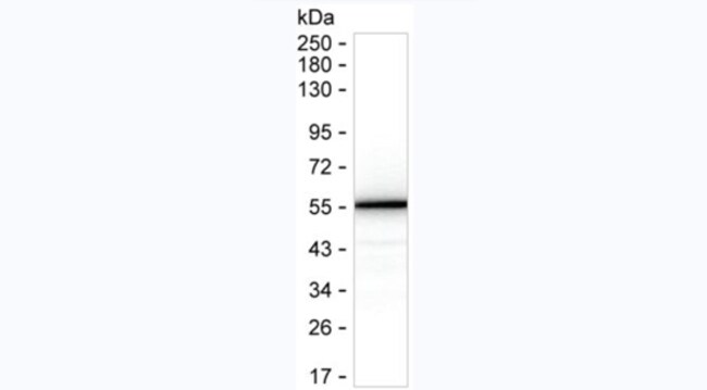 Invitrogen SARS-CoV-2 Nucleocapsid Monoclonal Antibody (2G5) 100 μg ...