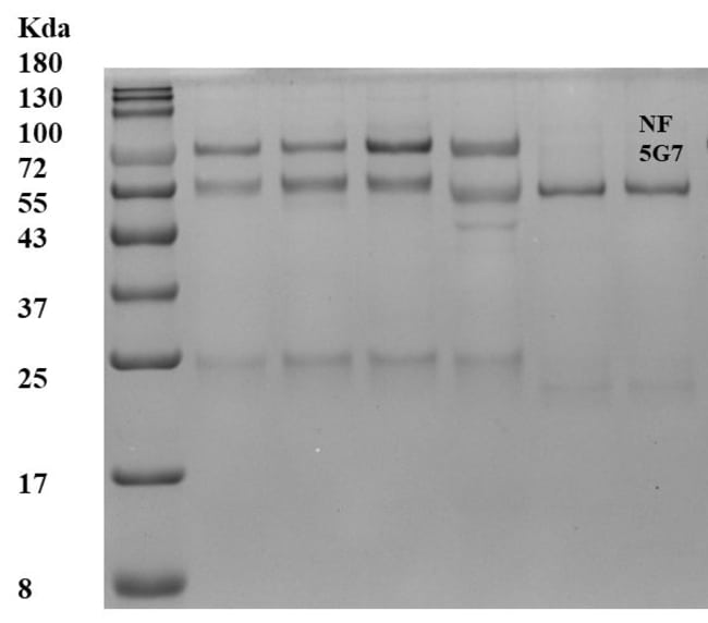Nitrofen Monoclonal Antibody (5G7), Invitrogen 200 μg, Unconjugated:Antibodies, | Fisher Scientific