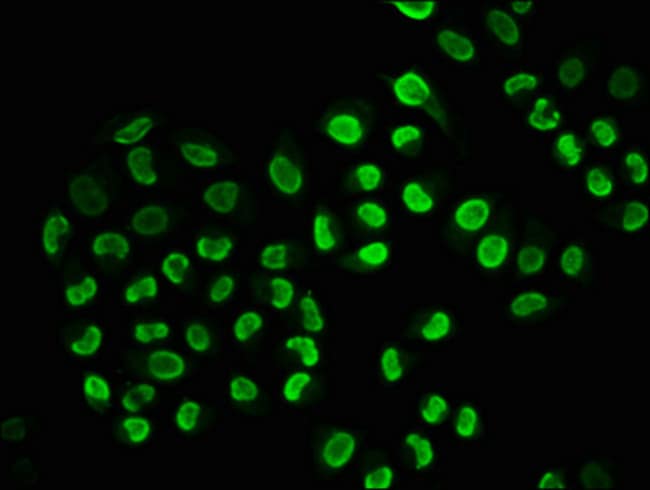 Phospho-alpha Synuclein (Ser129) Recombinant Rabbit Monoclonal Antibody ...
