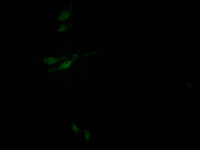 SIN3A Recombinant Rabbit Monoclonal Antibody (10G3), Invitrogen 100 μL ...