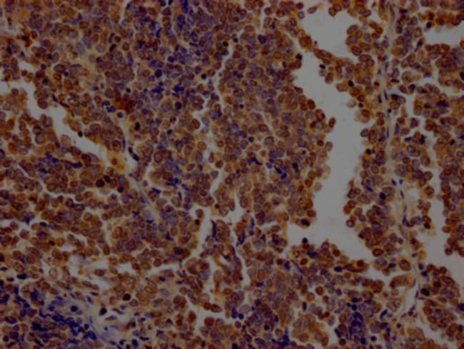 OGT Recombinant Rabbit Monoclonal Antibody (8G7), Invitrogen 100 μL ...