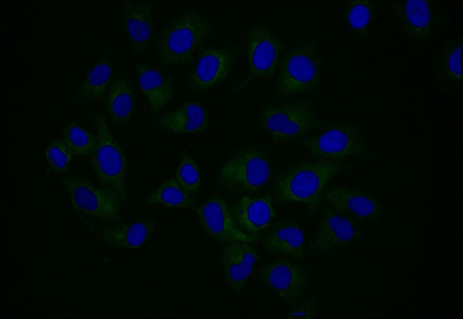 Npr2 Recombinant Rabbit Monoclonal Antibody (19C7), Invitrogen 100 μL ...