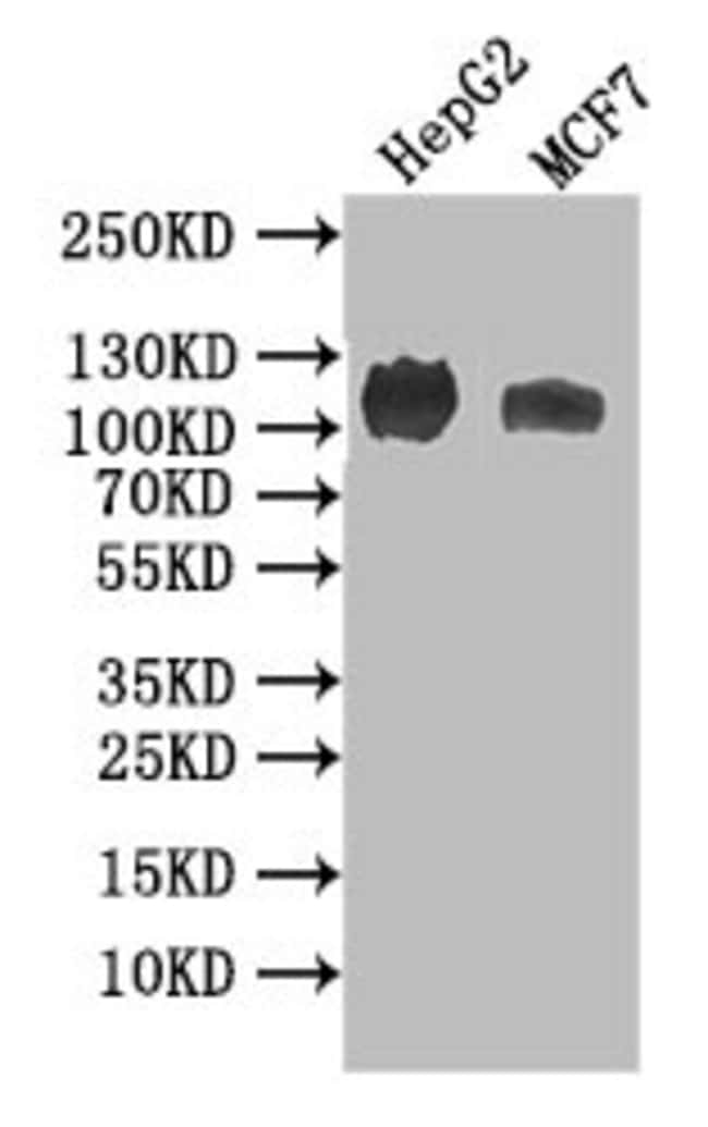 Npr2 Recombinant Rabbit Monoclonal Antibody (19C7), Invitrogen 100 μL ...