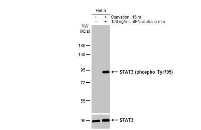Phospho-STAT3 (Tyr705) Recombinant Rabbit Monoclonal Antibody (HL1464), | Fisher Scientific