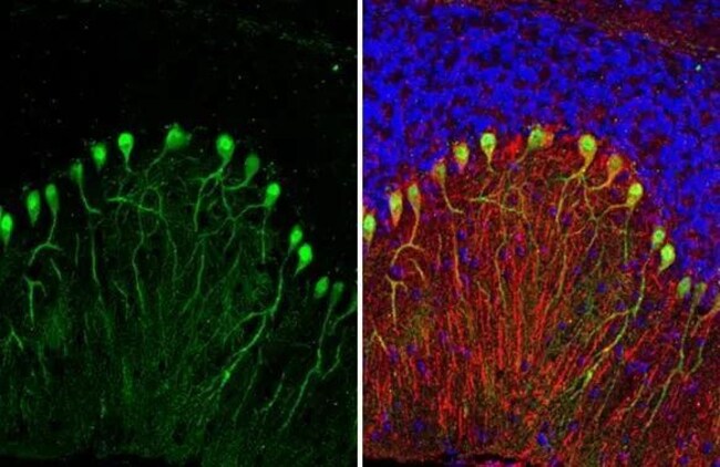 Calbindin/Calretinin Recombinant Rabbit Monoclonal Antibody (HL1787 ...