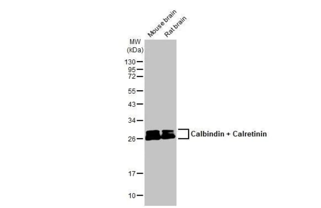 Calbindin/Calretinin Recombinant Rabbit Monoclonal Antibody (HL1787 ...