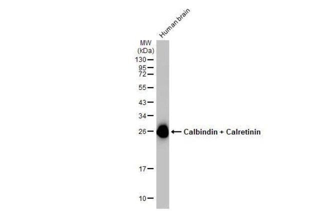 Calbindin/Calretinin Recombinant Rabbit Monoclonal Antibody (HL1787 ...