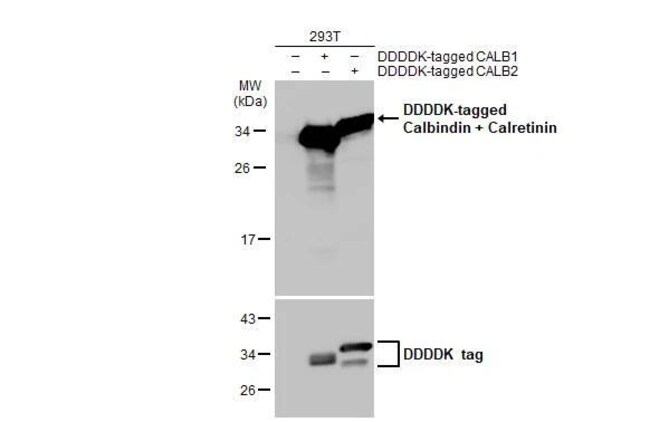 Calbindin/Calretinin Recombinant Rabbit Monoclonal Antibody (HL1787 ...