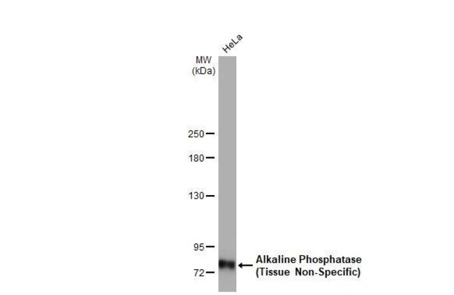 ALPL Recombinant Rabbit Monoclonal Antibody (HL2003), Invitrogen 100 μL ...