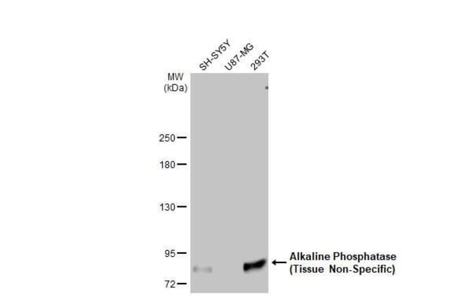 ALPL Recombinant Rabbit Monoclonal Antibody (HL2003), Invitrogen 100 μL ...