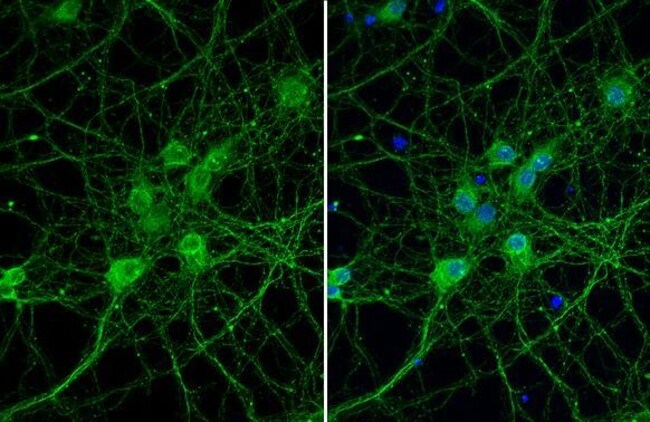 PIN1 Recombinant Rabbit Monoclonal Antibody (HL2115), Invitrogen 100 μL ...