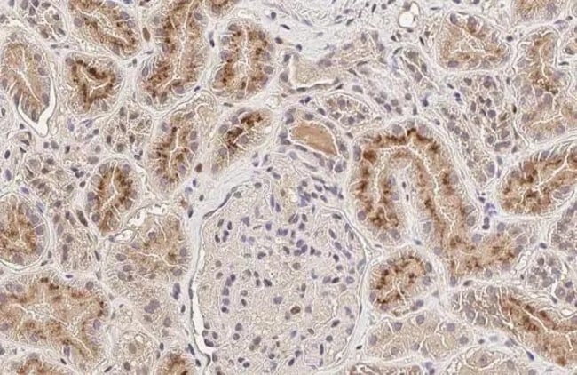 RNASE2 Recombinant Rabbit Monoclonal Antibody (HL2166), Invitrogen 100 ...