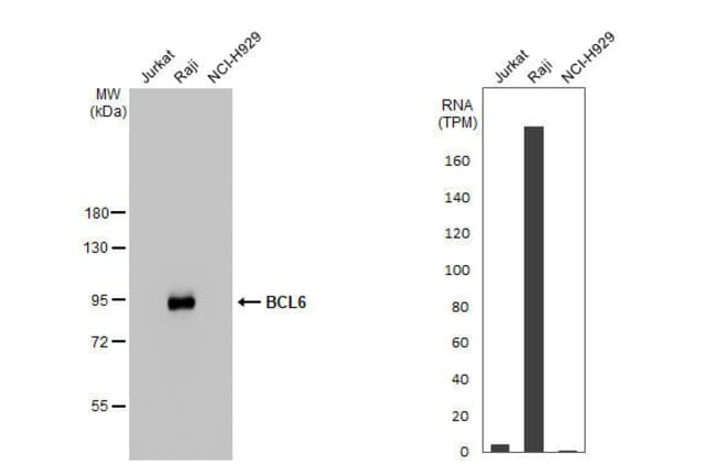 BCL6 Recombinant Rabbit Monoclonal Antibody (HL2192), Invitrogen 100 μL ...