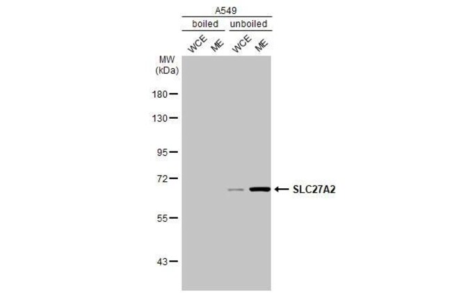 SLC27A2 Recombinant Rabbit Monoclonal Antibody (HL2232), Invitrogen 100 ...