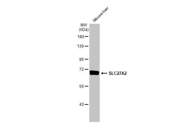 SLC27A2 Recombinant Rabbit Monoclonal Antibody (HL2232), Invitrogen 100 ...