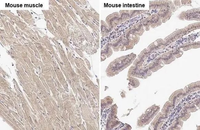 SPG7 Recombinant Rabbit Monoclonal Antibody (HL2236), Invitrogen 100 μL ...