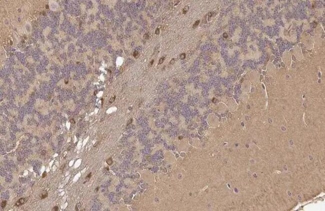 Invitrogen PSAT1 Recombinant Rabbit Monoclonal Antibody (HL2270) 100 μL ...