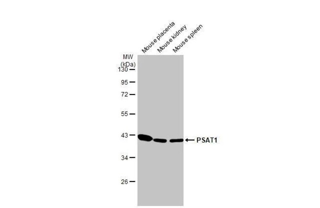 Invitrogen PSAT1 Recombinant Rabbit Monoclonal Antibody (HL2270) 100 μL ...