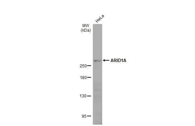 ARID1A Recombinant Rabbit Monoclonal Antibody (HL2304), Invitrogen 100 ...