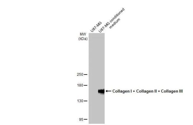Collagen I/II/III Recombinant Rabbit Monoclonal Antibody (HL2048/HL1907 ...