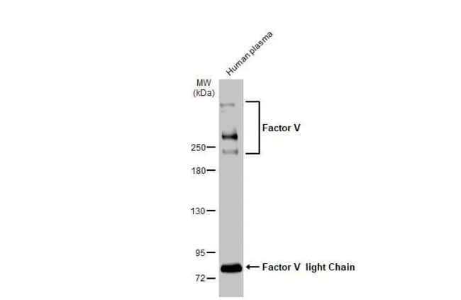 Factor V Recombinant Rabbit Monoclonal Antibody (HL2421), Invitrogen ...