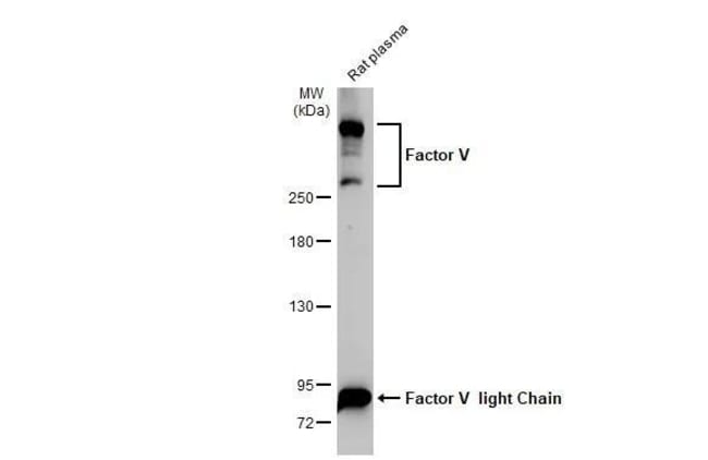 Factor V Recombinant Rabbit Monoclonal Antibody (HL2421), Invitrogen ...